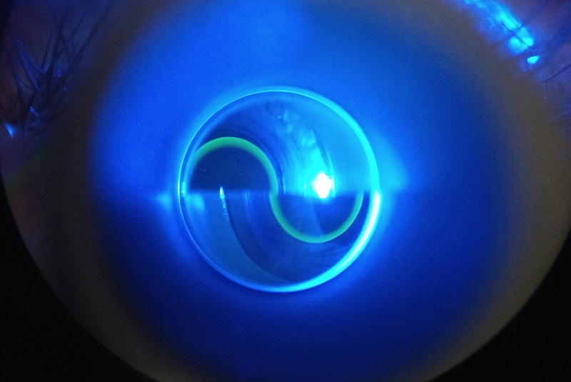Glaucoma Information How Is Tonometry Done Glaucoma Information